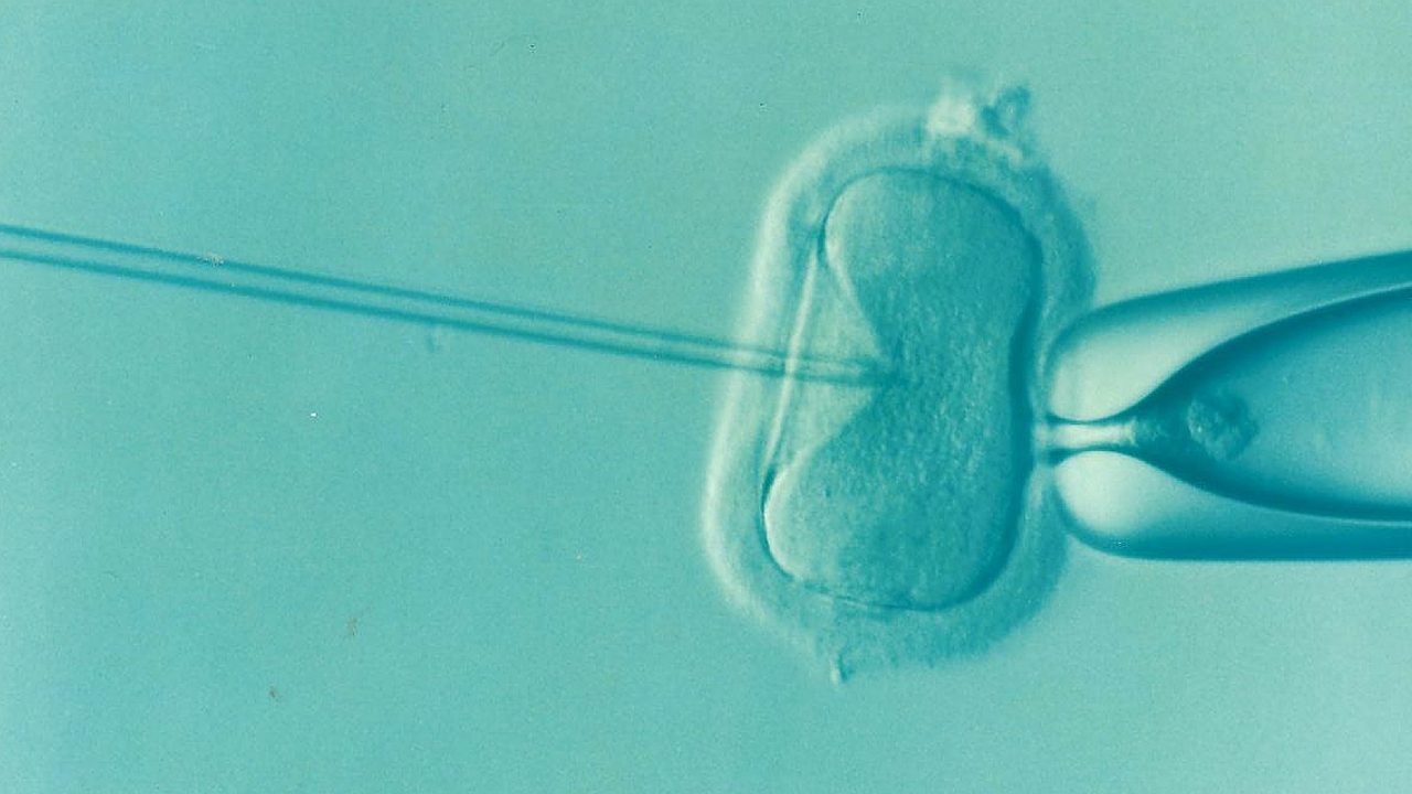 Essential Facts About IVF You Should Know